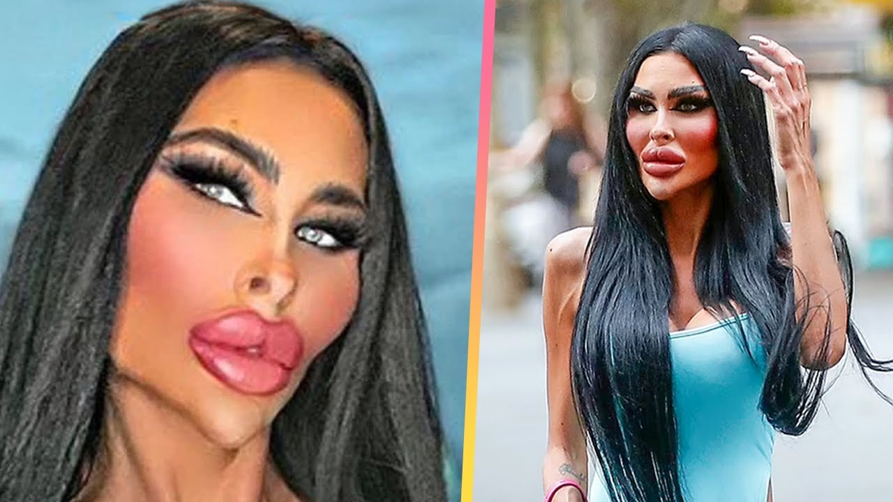 BOTCHED Plastic Surgery That Made Celebrities Unrecognizable | Marathon ...