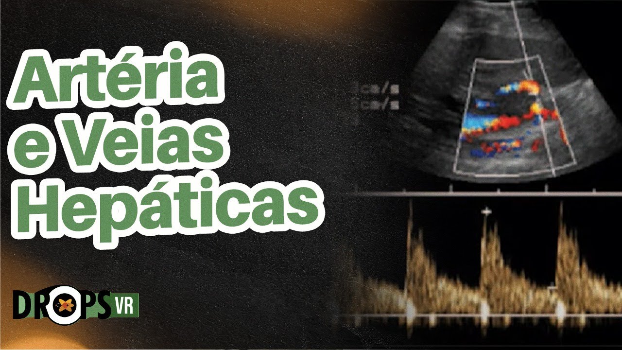 ARTÉRIA E VEIAS HEPÁTICAS - RECONHECENDO NO USG I VOCÊ RADIOLOGISTA ...