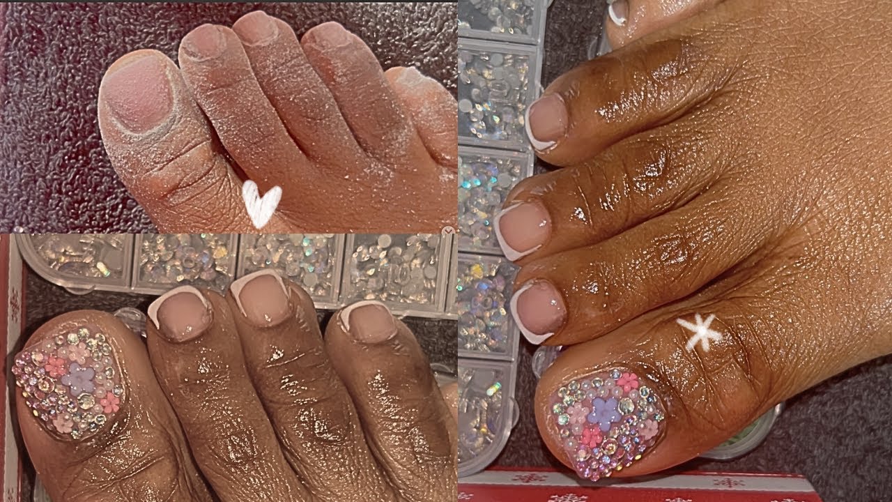 *REQUESTED* Cute toenail art | Dead skin removal | Pedicure using The ...