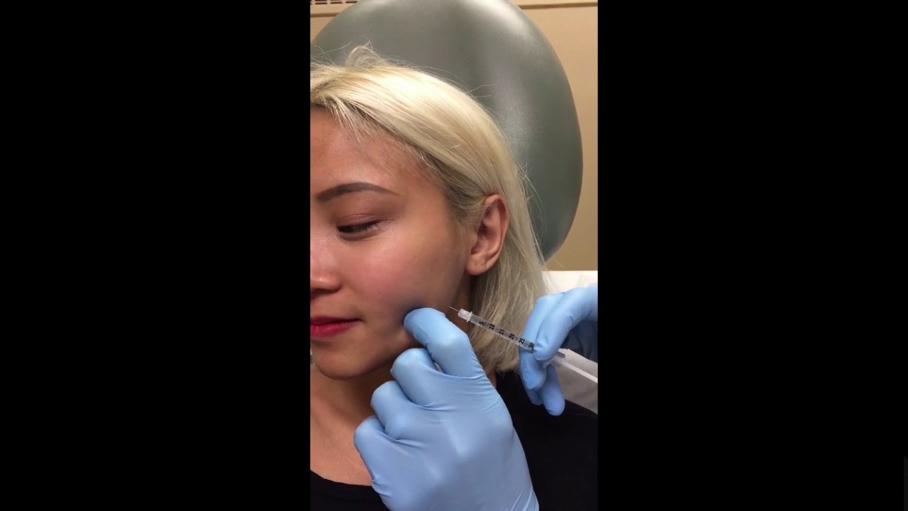 Botox injection for jawline reduction, face shaping, and teeth grinding ...
