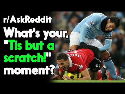 "Tis but a scratch" Moments r/AskReddit Reddit Stories | Top Posts ...
