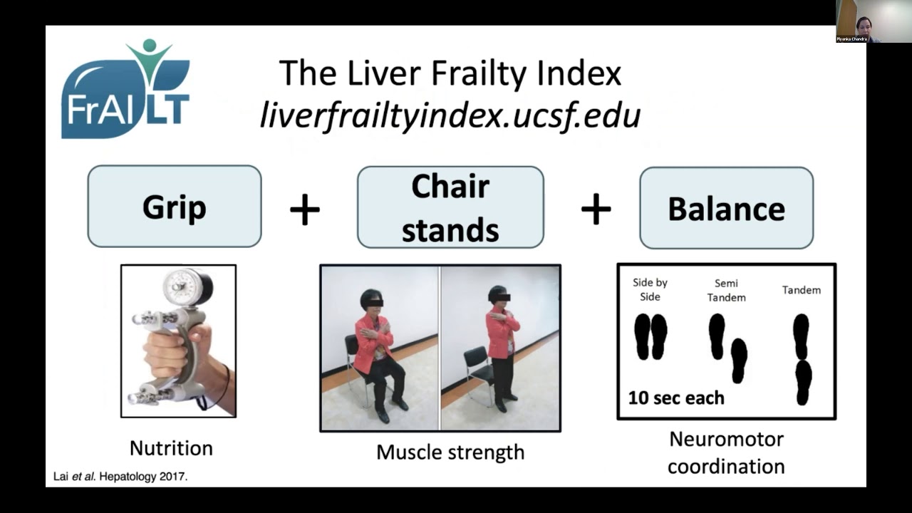 Frailty in Patients with Cirrhosis: From Recognition to Reversal ...