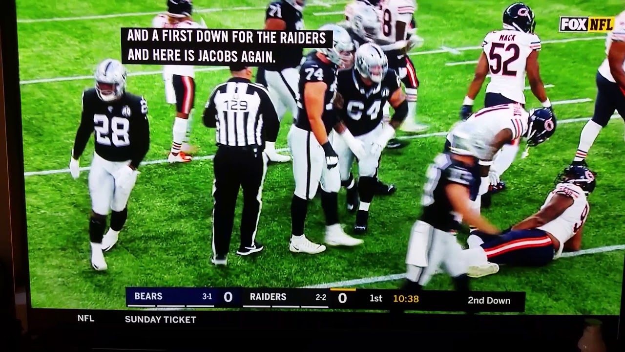 Elbow Dislocation Football