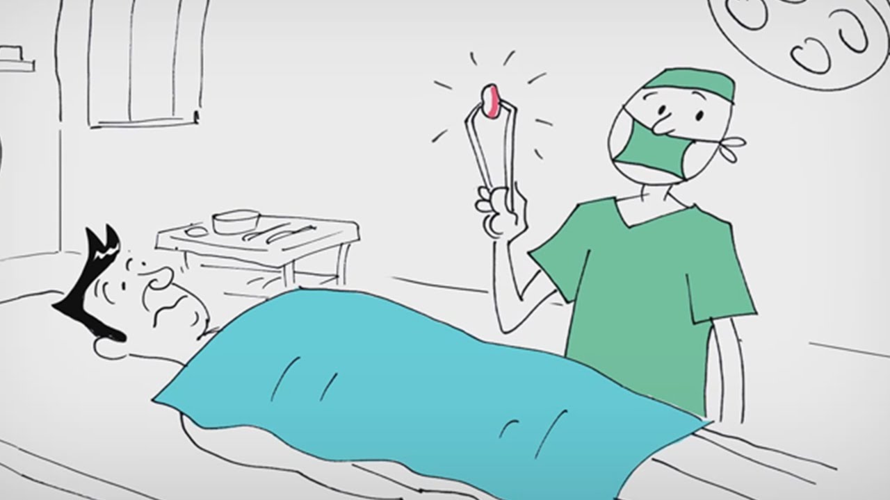 Medical Animation: What is BPH- Benign Prostatic Hyperplasia - YouTube