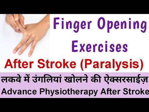 लकवा में उंगलियां खोलने की ऐक्सरसाईज़, Finger Opening Exercise and Hand ...