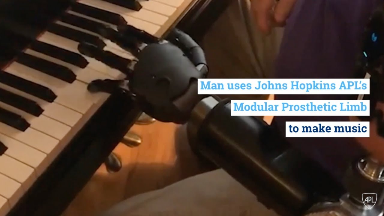 Amputee Makes Music with the Modular Prosthetic Limb - YouTube
