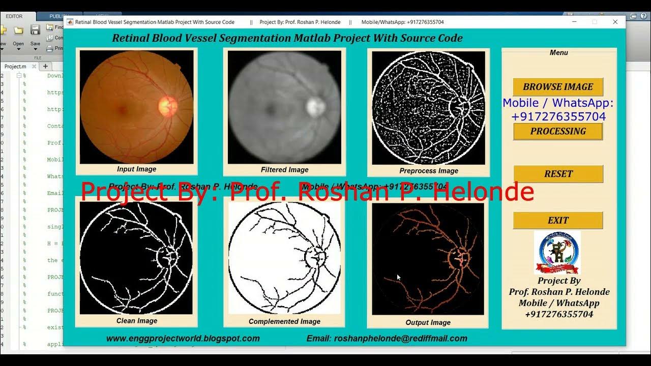 Retinal Blood Vessel Segmentation | With Source Code | Matlab Project Retinal Blood Vessel ...