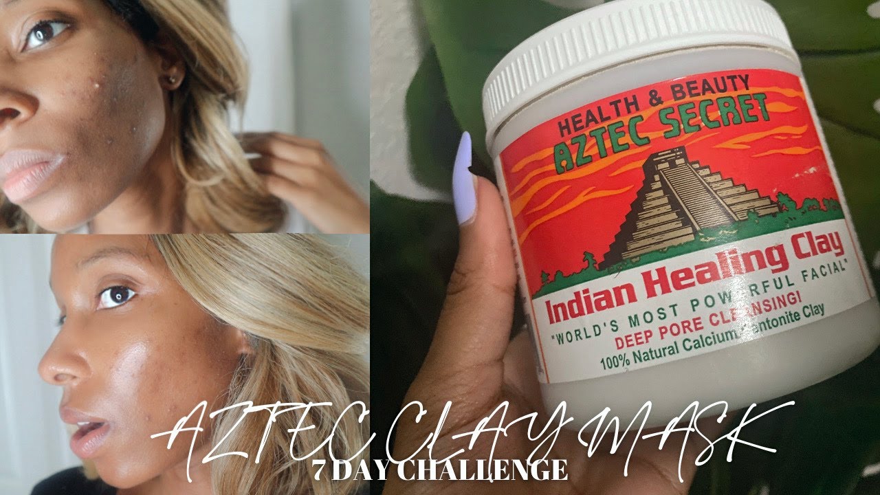 I USED THE AZTEC CLAY MASK ON MY SKIN FOR 7 DAYS STRAIGHT! DOES IT ...