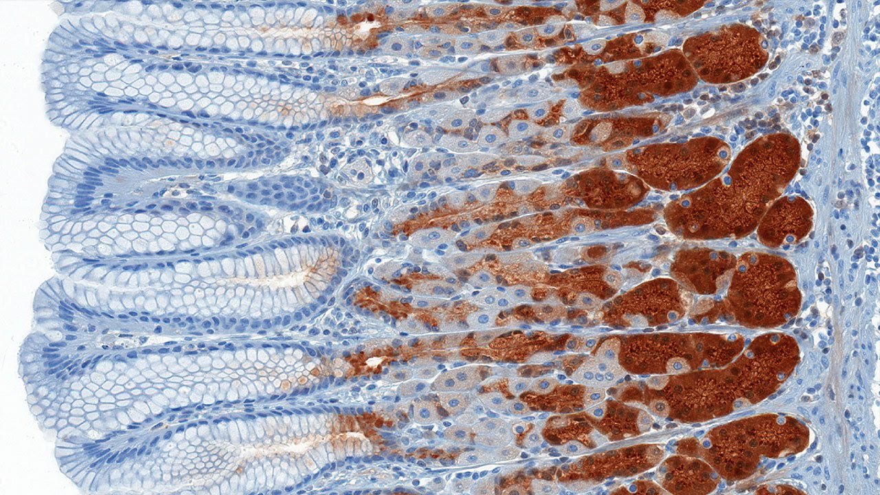 Human Physiology - Regulation of Digestion: Mechanisms for HCl and ...