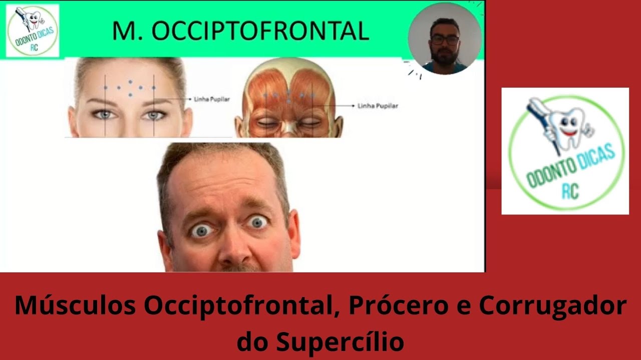 Músculos da mímica facial: músculos occiptofrontal, prócero e ...