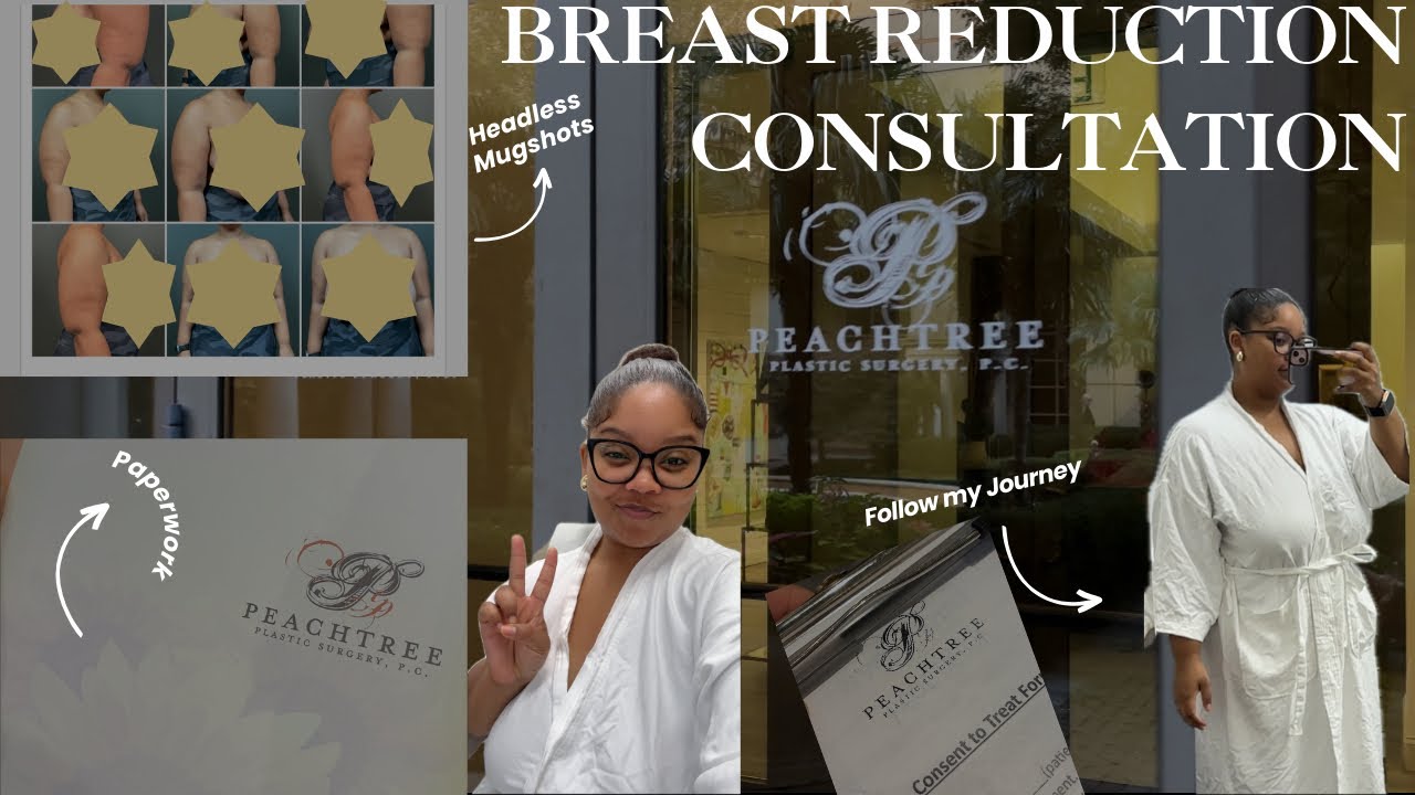 Breast Reduction Consultation: My First Step Towards Comfort ...