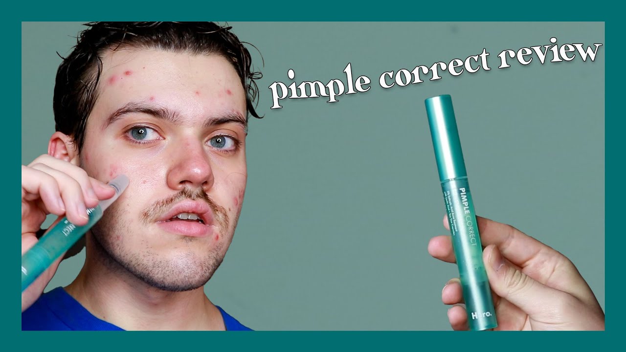 hero cosmetics pimple correct review - YouTube