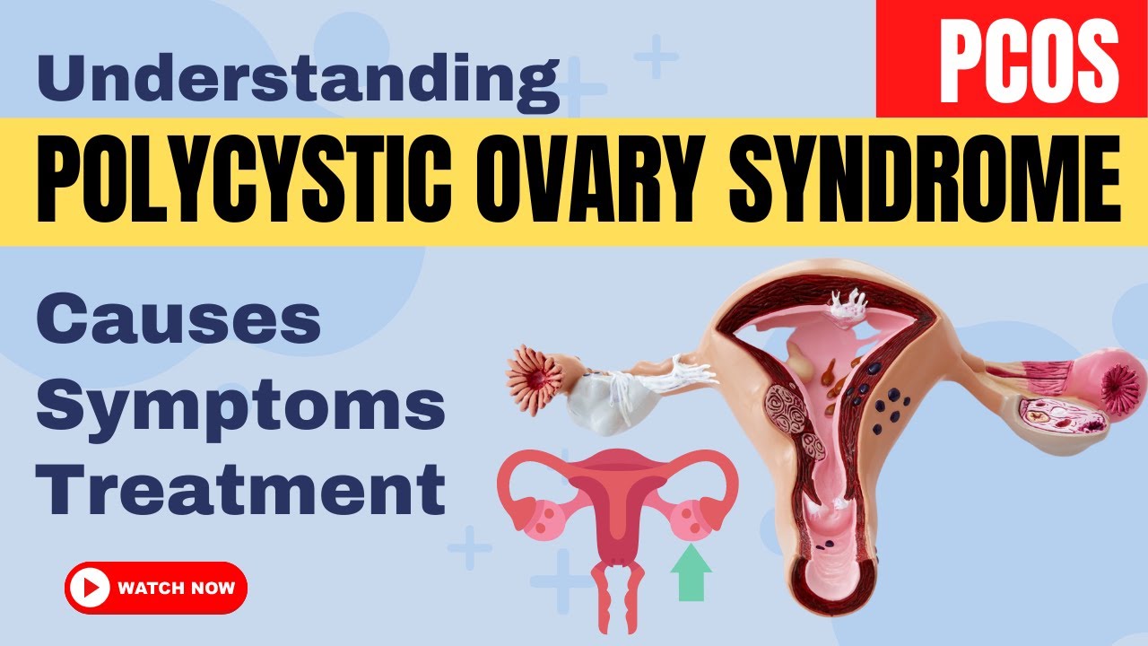 Understanding Polycystic Ovary Syndrome | PCOS Causes, Symptoms, and ...