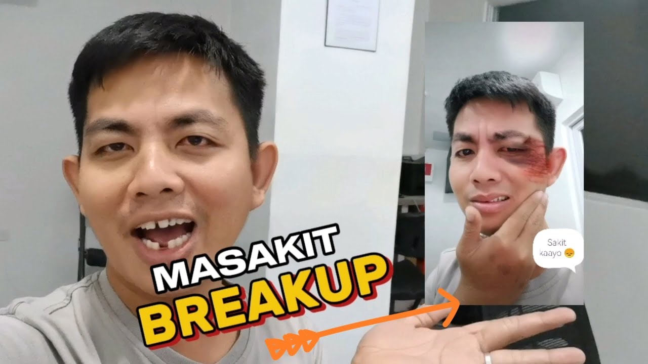 Ang tinamo kong sugat | Prank - YouTube