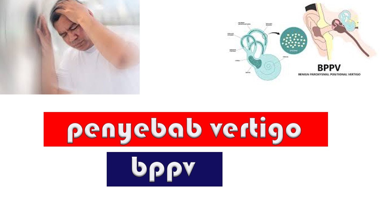 PENYEBAB VERTIGO || BPPV || PENYAKIT PENYEBAB VERTIGO PERIFER - YouTube