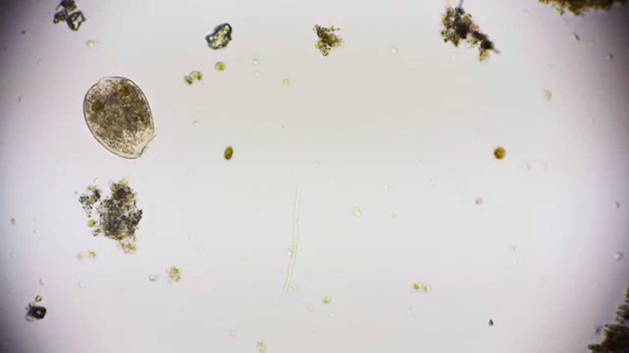 Wimpertierchen - Ciliophora - Ciliata - Ciliate - microorganisms under ...