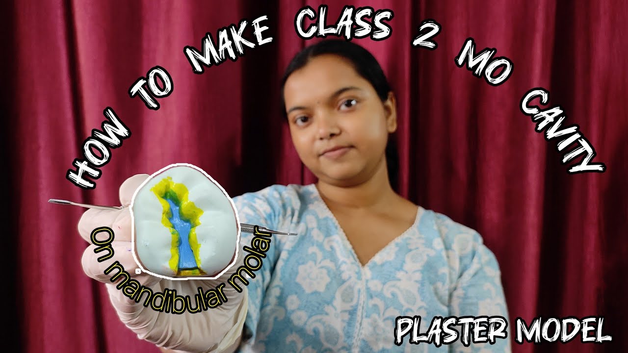 How to make Class 2 MO Cavity on Mandibular Molar | Plaster Model | Pre ...