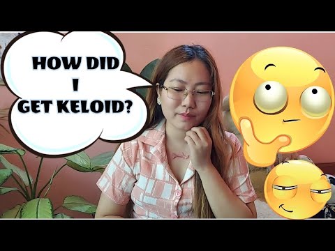 WHAT IS KELOID? ||Naga girl #nagaland #india - YouTube