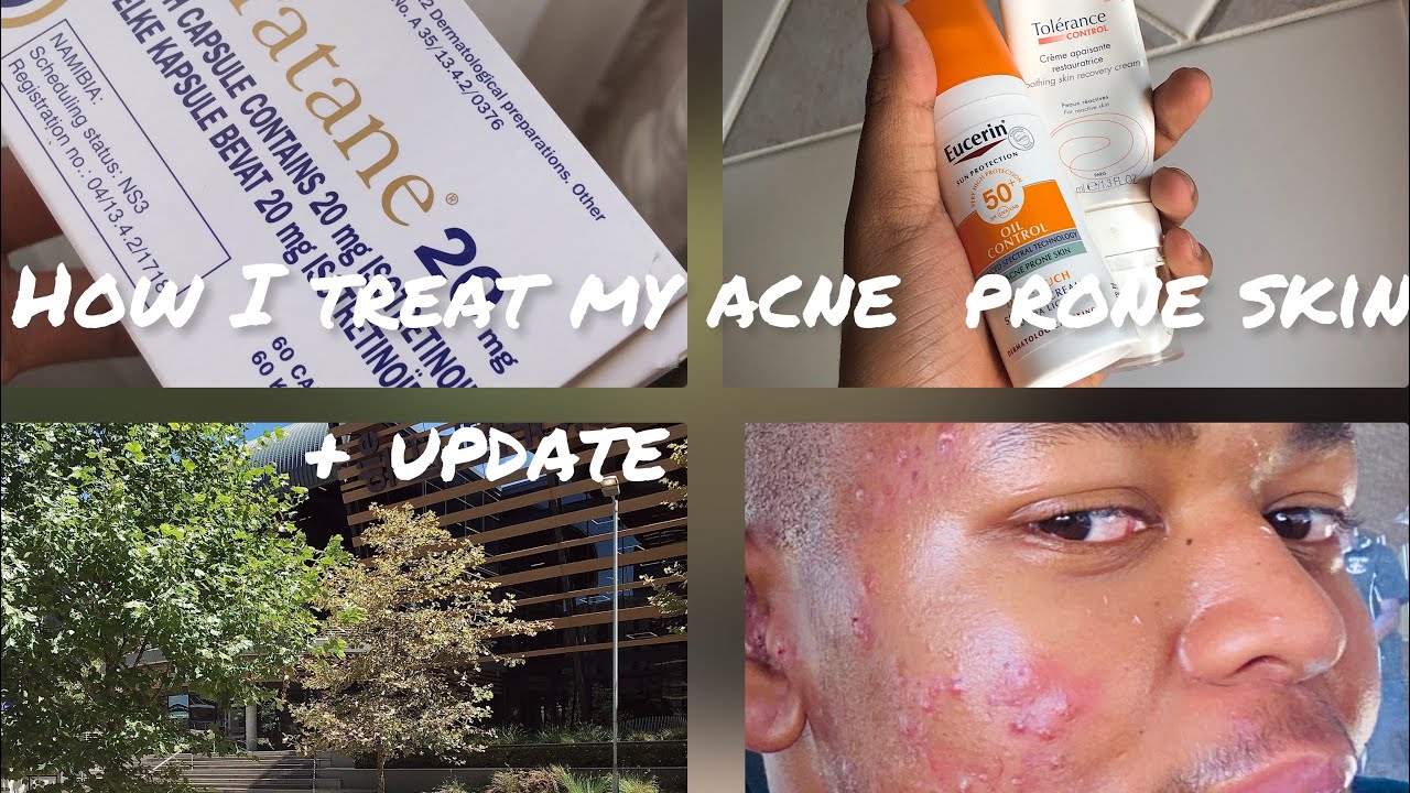 Updated skin care routine: Oratane? + Life update | South African ...