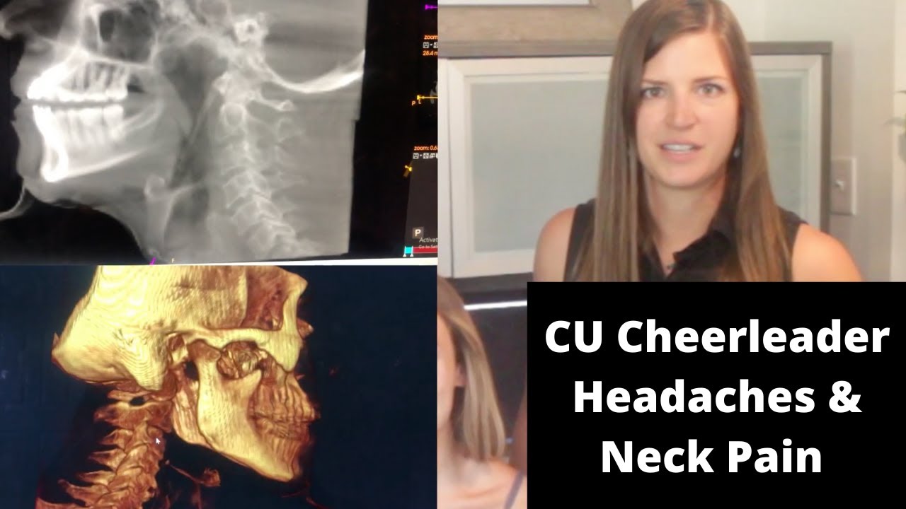 CU Boulder Cheerleader: Headaches & Neck Pain Treatment at Upper ...