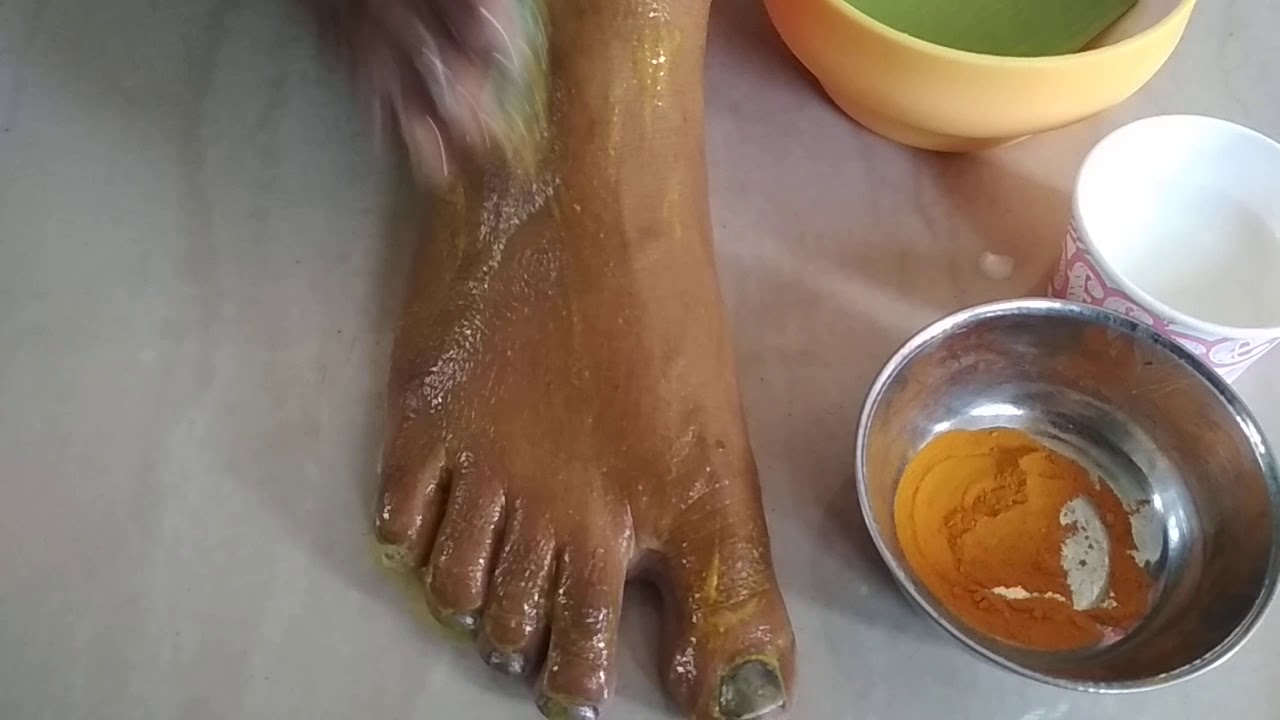 Bleach for legs very effective - YouTube
