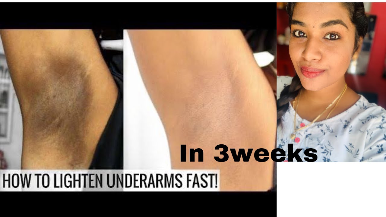 GEt RID OF UNDERARM DARKNESS IN 3WEEKS |HOMEMADE REMEDIES | PUNNAGAIPEN ...