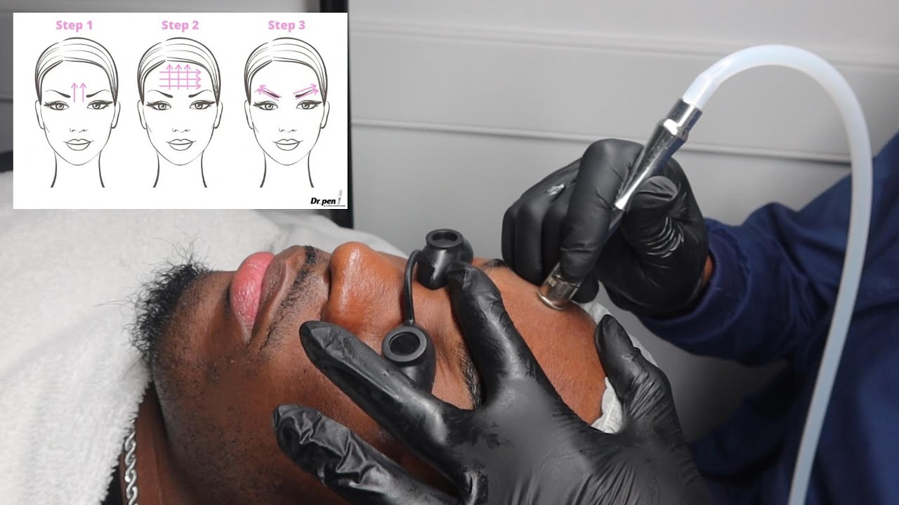 MICRODERMABRASION FACIAL (STEP BY STEP) - YouTube