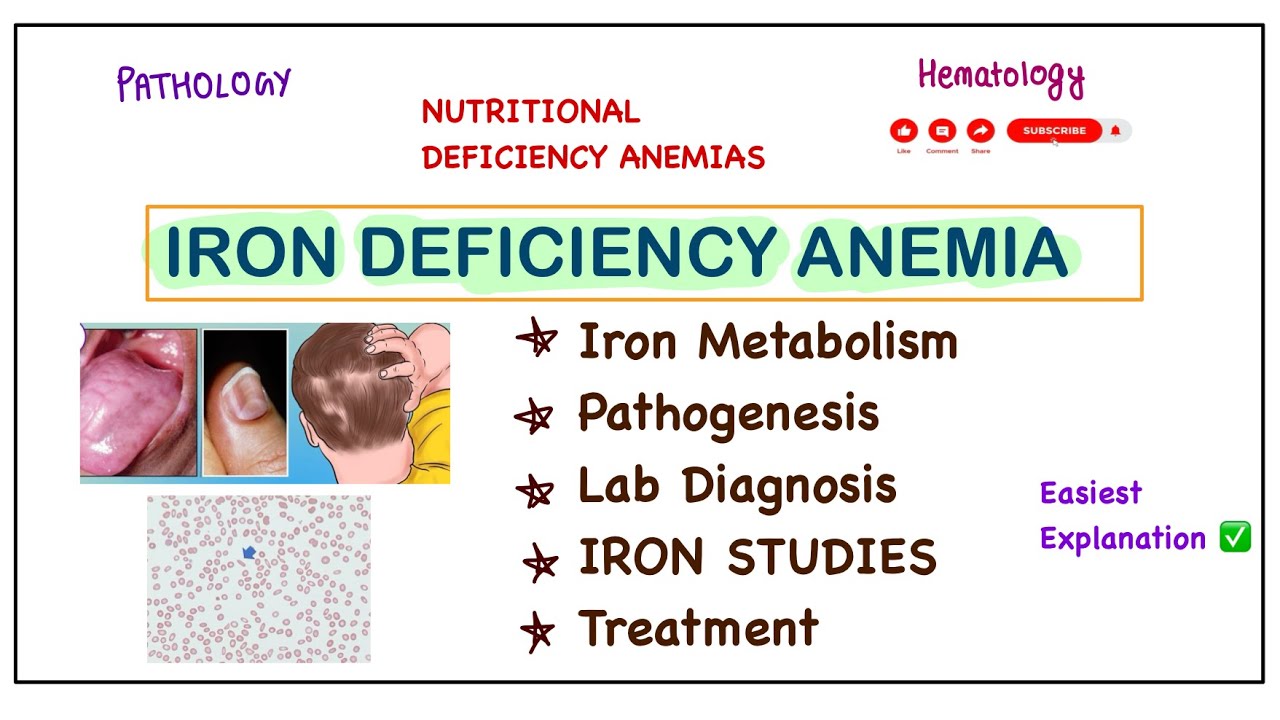 Iron Deficiency Anemia | Pathophysiology, Symptoms, Lab Diagnosis ...