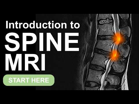 How to Read Spine MRI: Anatomy & Approach