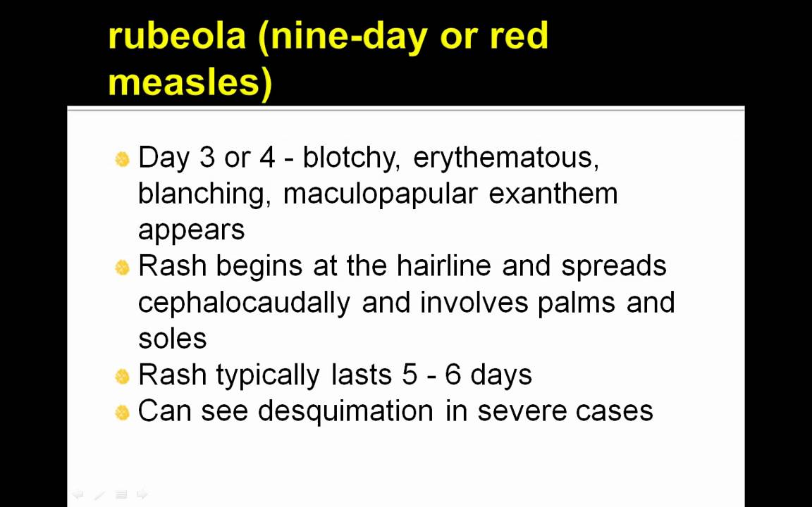 USMLE COMLEX Board Review of Rubeola Measles - YouTube