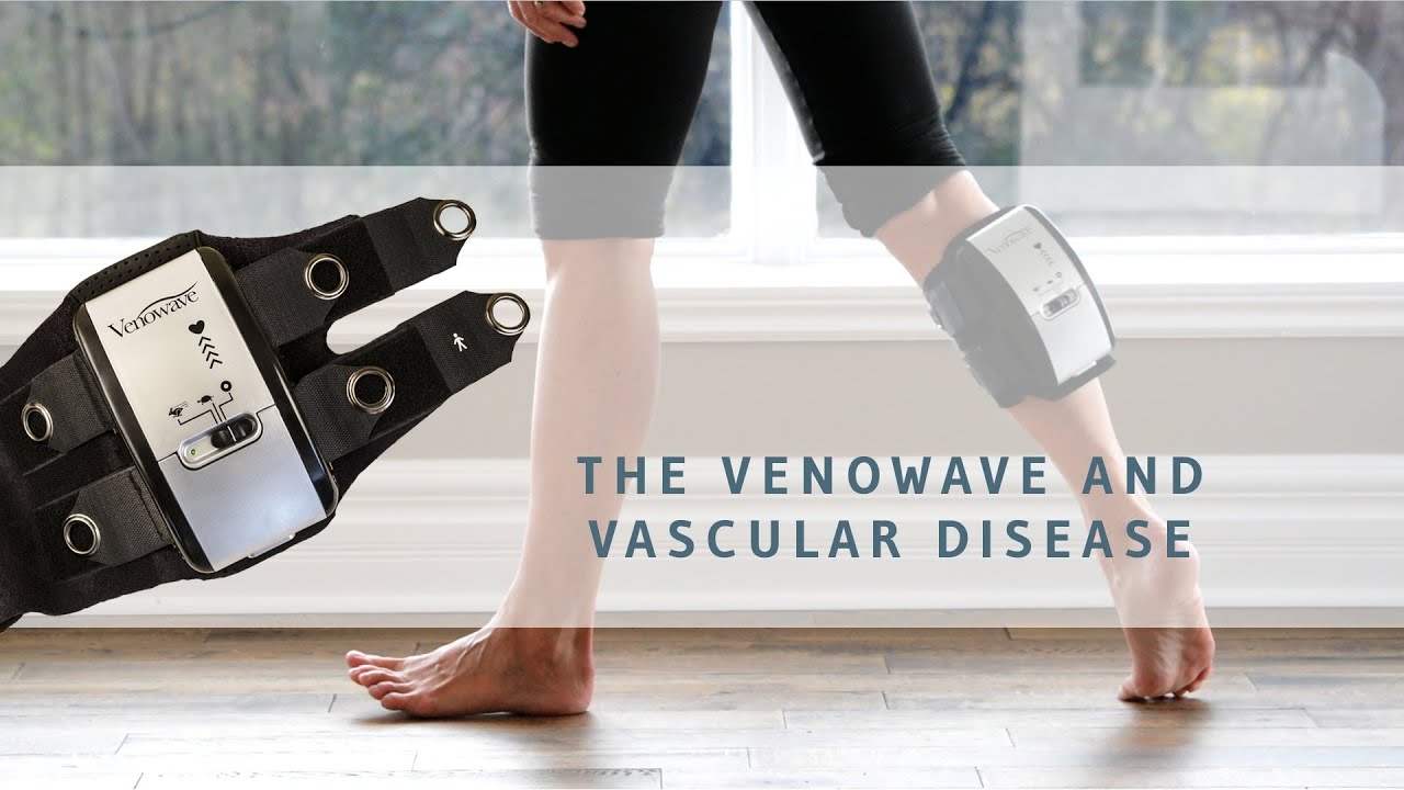 The Venowave and Vascular Disease - YouTube
