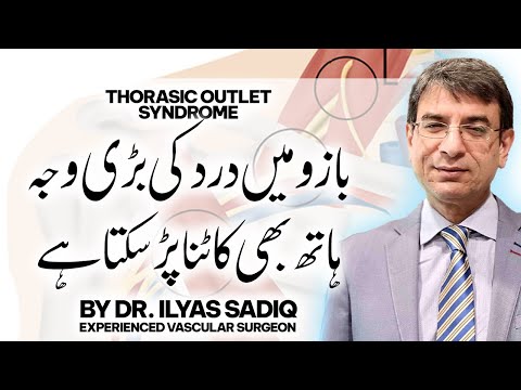 Thoracic Outlet Syndrome! Causes, Symptoms & Treatment By | Dr. Ilyas Sadiq Vascular Surgeon