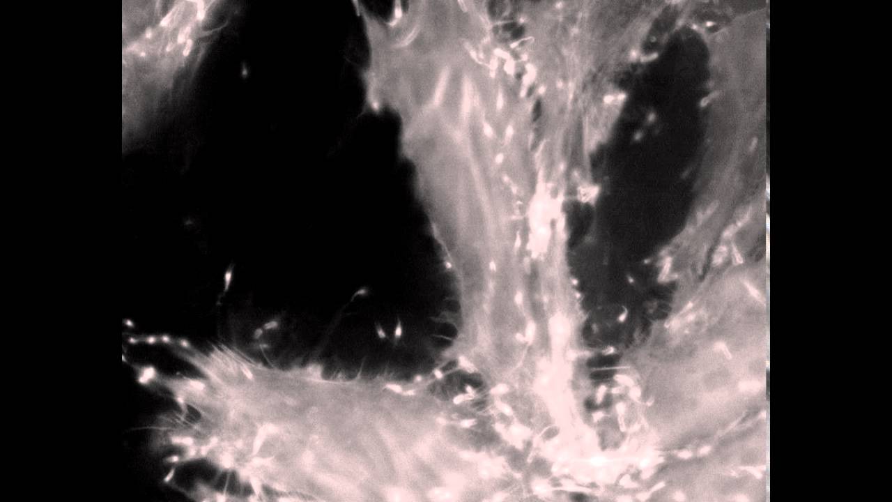 Listeria Monocytogenes intracellular motility - YouTube