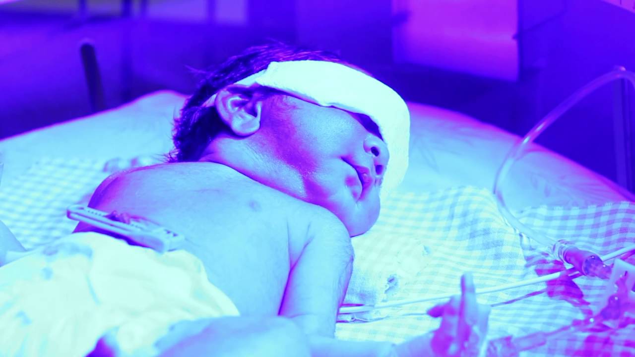 Brilliance LED Device and Equipments for Neonatal Phototherapy ...