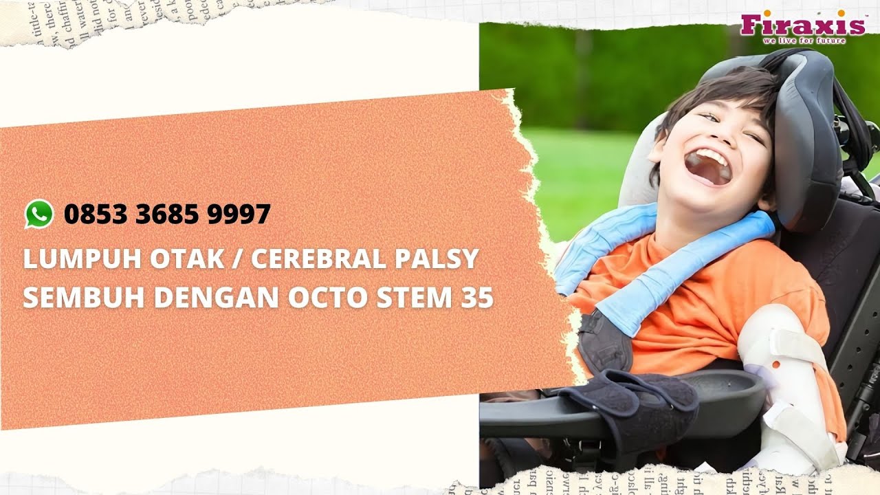 Cara Mengobati Cerebral Palsy | Obat Cerebral Palsy | OCTO STEM 35 ...