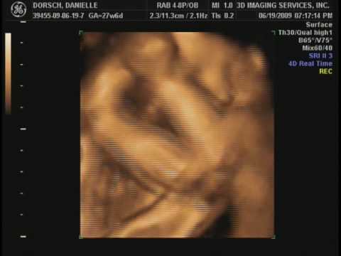 Rylee Maria - 28 weeks - 3d Ultrasound - Part 5 - YouTube