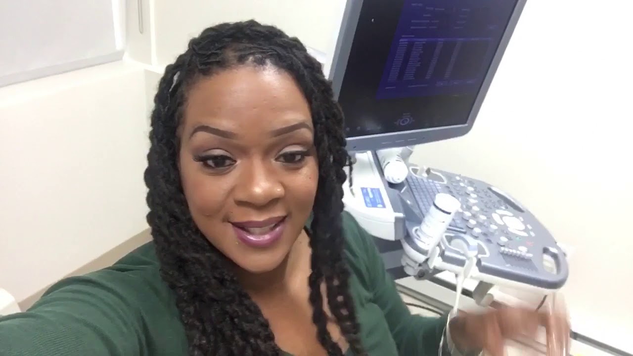 Cycle Day 13 Follicle Scan:Cycle#2 Zero symptoms w/ Clomid - YouTube