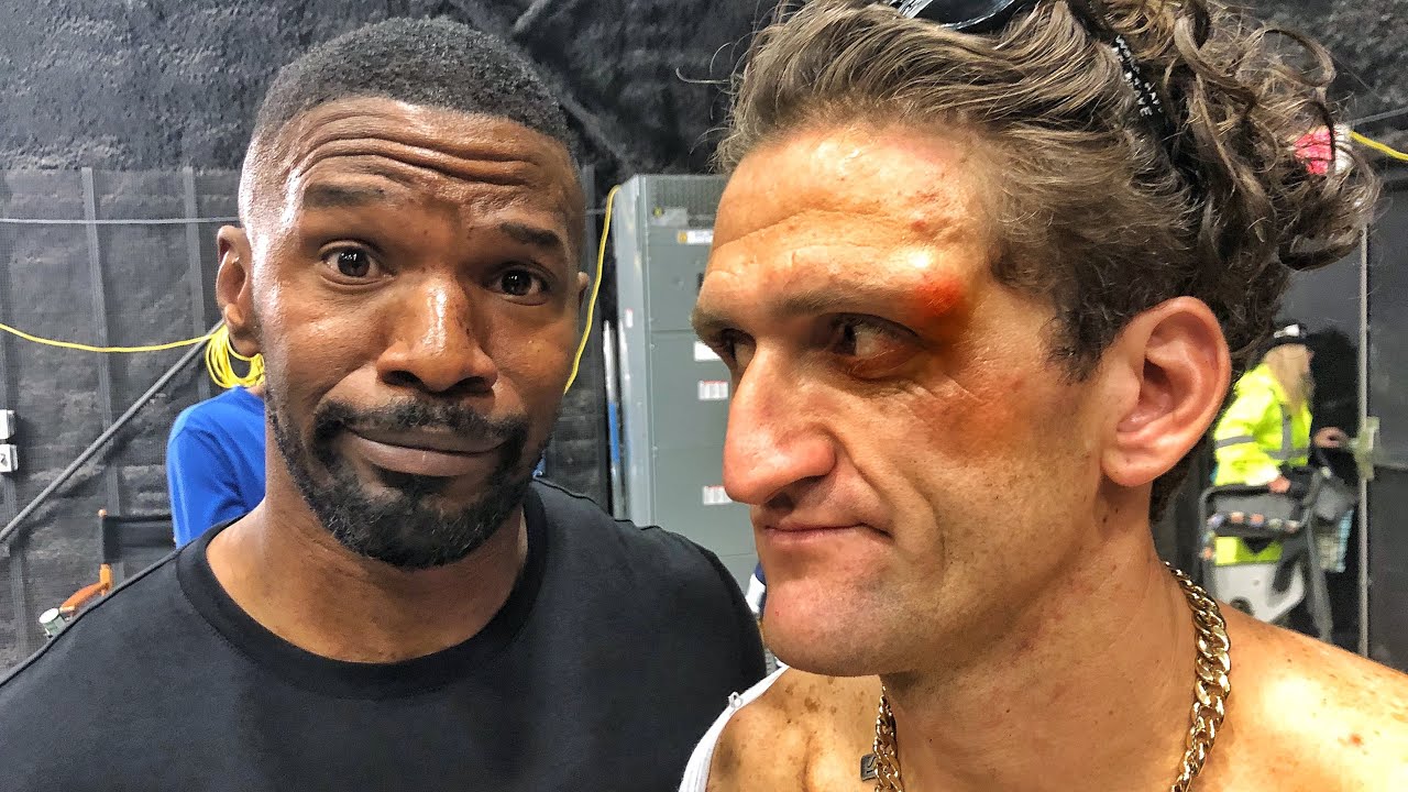 JAMIE FOXX GAVE ME A BLACK EYE - YouTube