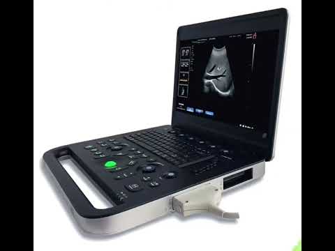 Portable color doppler ultrasound machine.