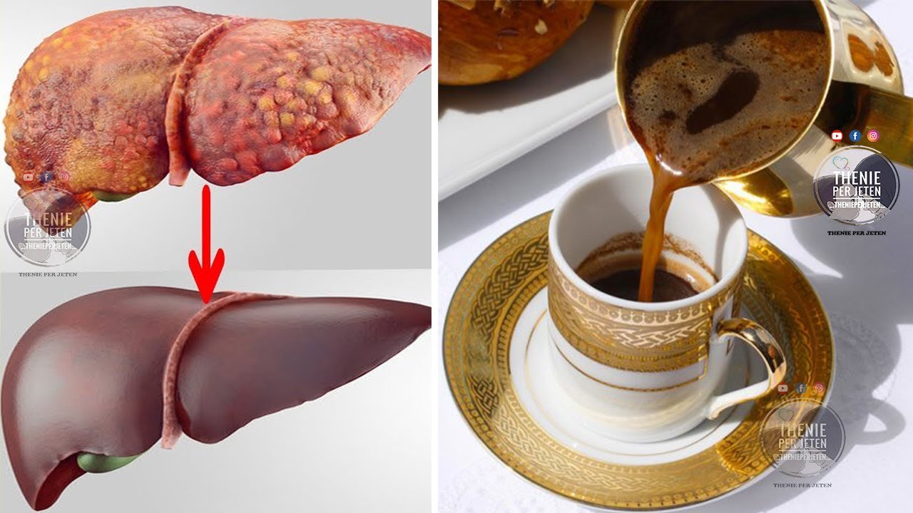 Pregatiteni kafen turke në këtë mënyrë për të trajtuar këto 7 probleme ...