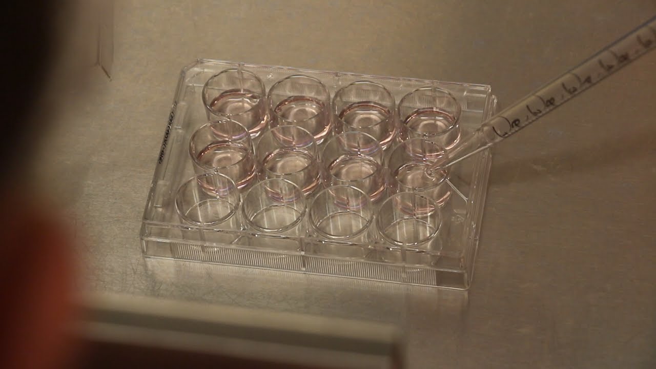 Transfection Tutorial - YouTube