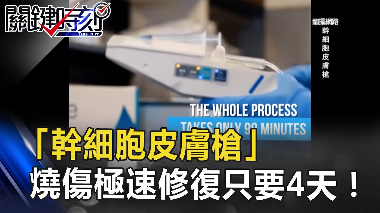 「幹細胞皮膚槍」 燒傷不用壓力衣不用植皮 極速修復只要4天！ 關鍵時刻 20170428-7 馬西屏 - YouTube