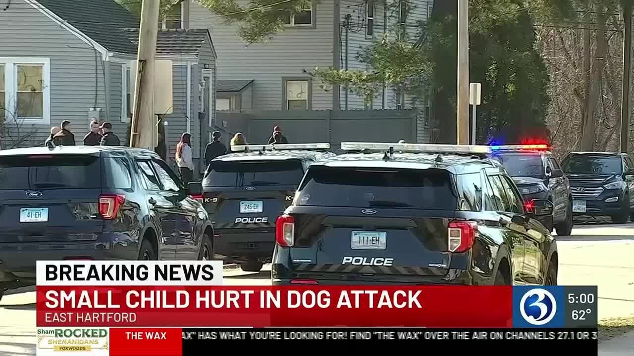 Small child hospitalized after dog attack in East Hartford - YouTube