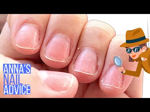 Why Are These Nails Weak? Find Out. [Anna's Nail Advice] - YouTube