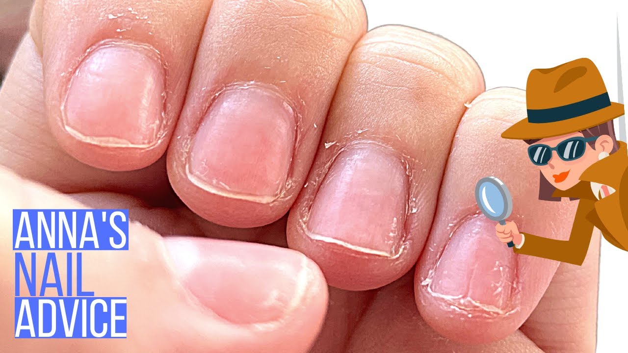 Why Are These Nails Weak? Find Out. [Anna's Nail Advice] - YouTube