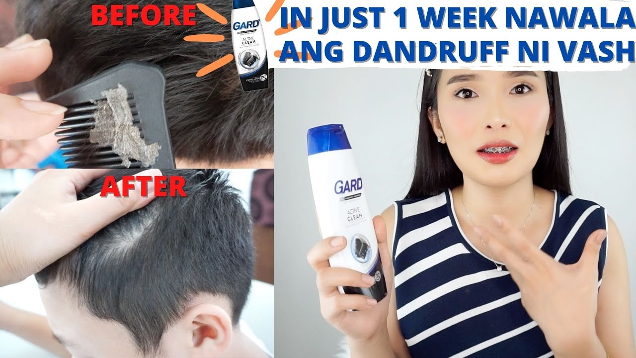 EFFECTIVE NA ANTI- DANDRUFF SHAMPOO| GARD HONEST REVIEW| GALY GASCON - YouTube