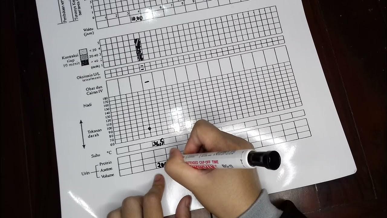 Mudah Pengisian atau Penulisan Partograf dalam Persalinan - YouTube