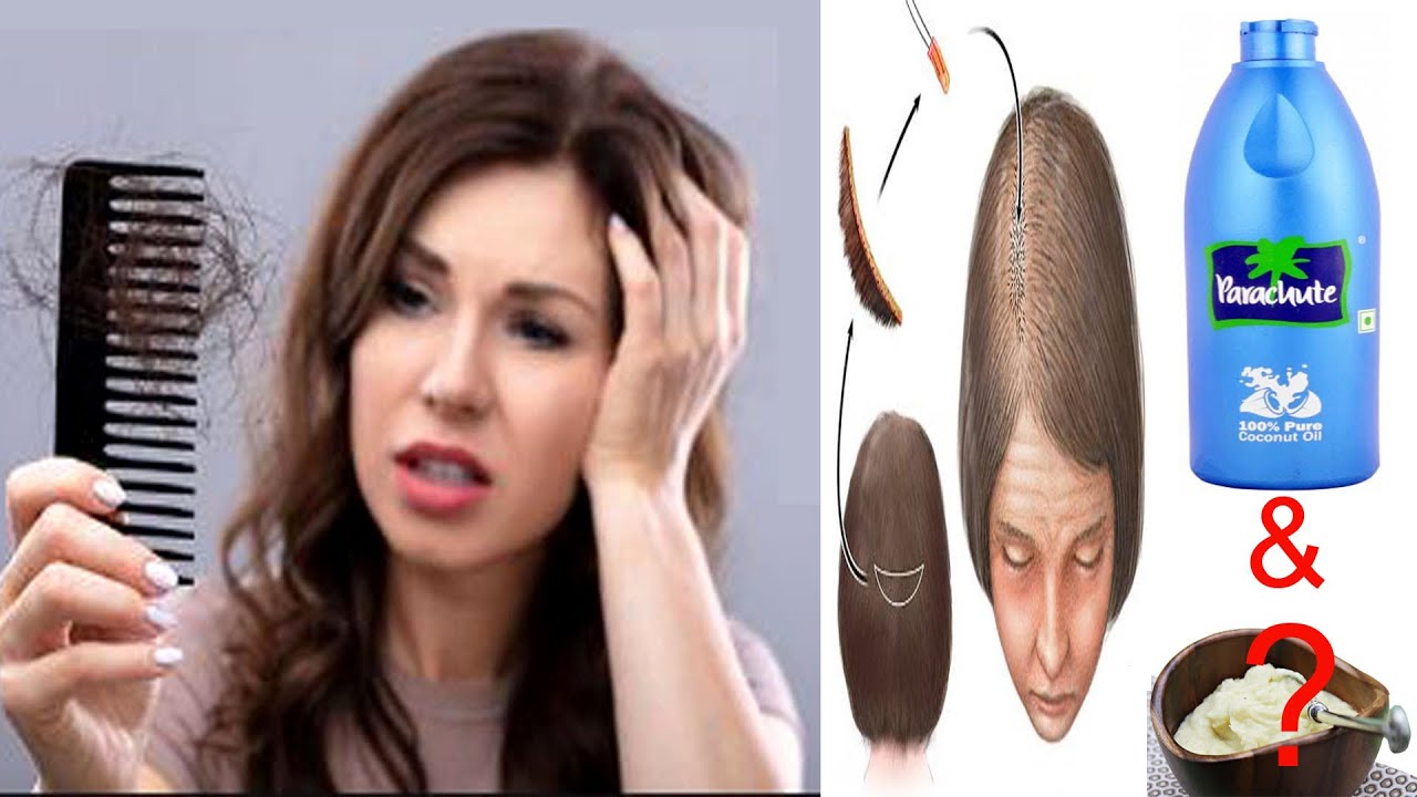 How To Stop Hair Fall In Just 2 Days Hair Fall Solution Youtube
