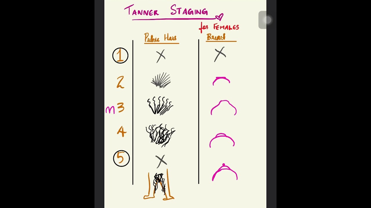 TANNER STAGING (pubarche,telarche )# NEET PG 2021 - YouTube