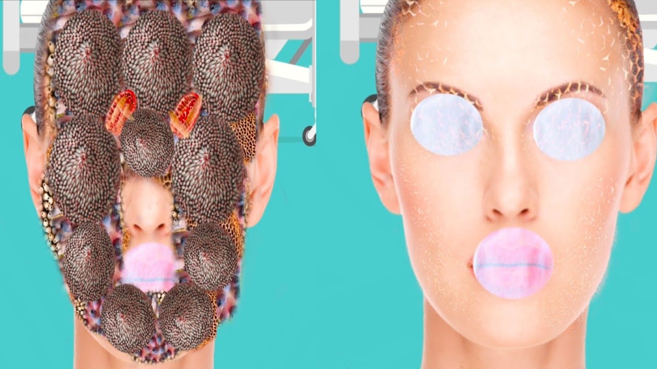 Asmr removal worm inflected face! 2d animation!asmr! @SanuAsmr_ - YouTube